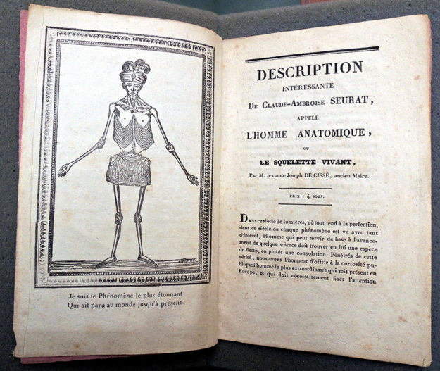 The Living Skeleton | Graphic Arts